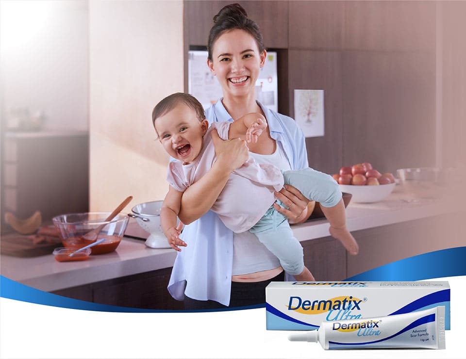 Dermatix® Indonesia - The gold standard in scar management